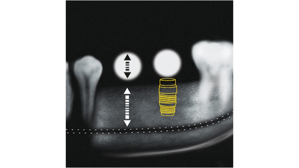 MEMOSIL 2 - the expert for special indications