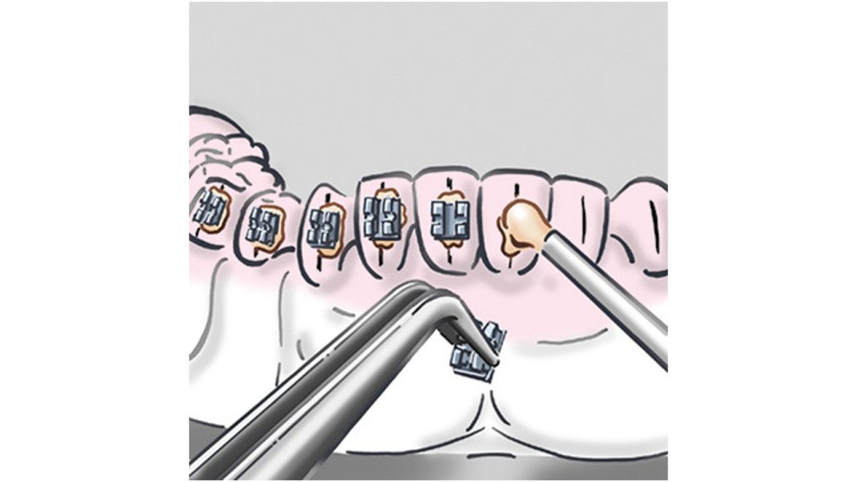 MEMOSIL 2 - the expert for special indications