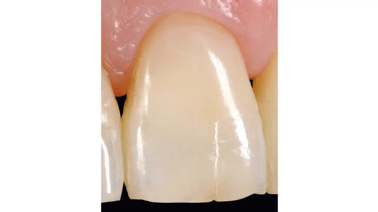 Venus® Diamond Flow