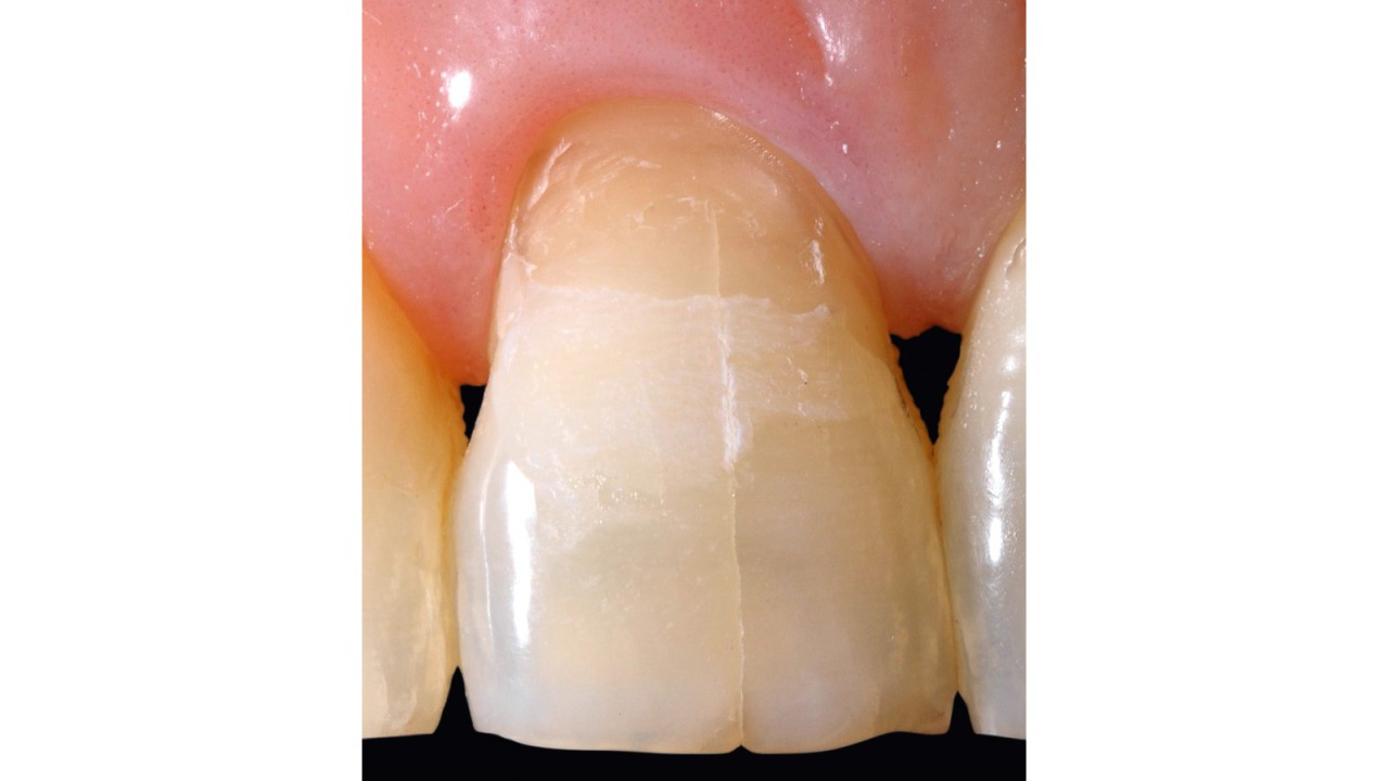 Venus® Diamond Flow