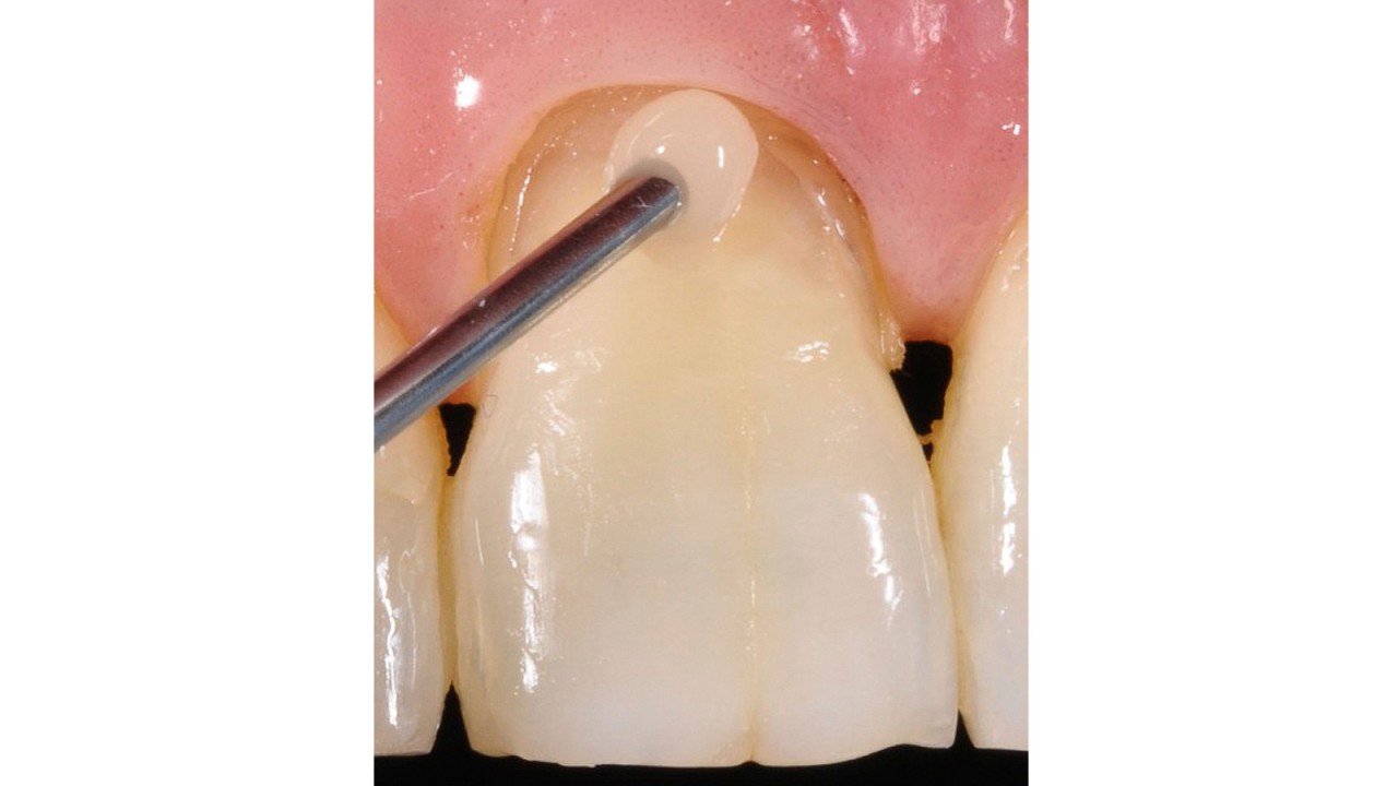 Venus® Diamond Flow