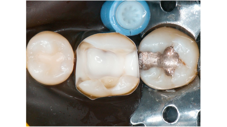 Venus Flow – Simply beautiful. Simply Venus.