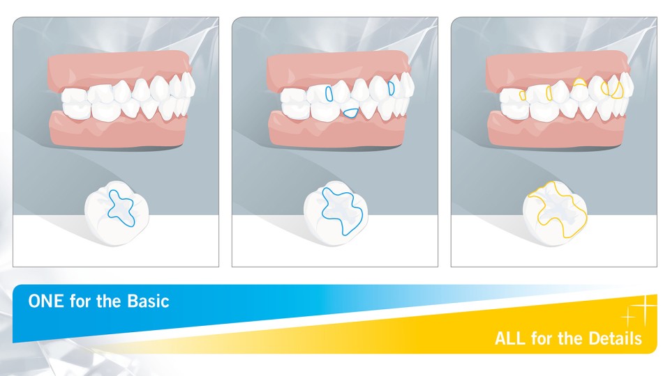 Venus® Pearl Shade Guide