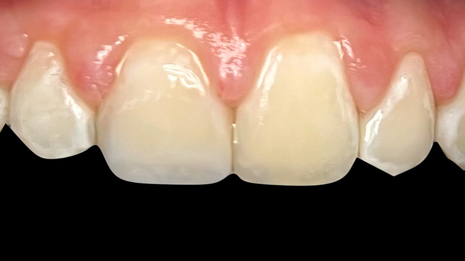 Venus® Pure Art and Pearl Shades