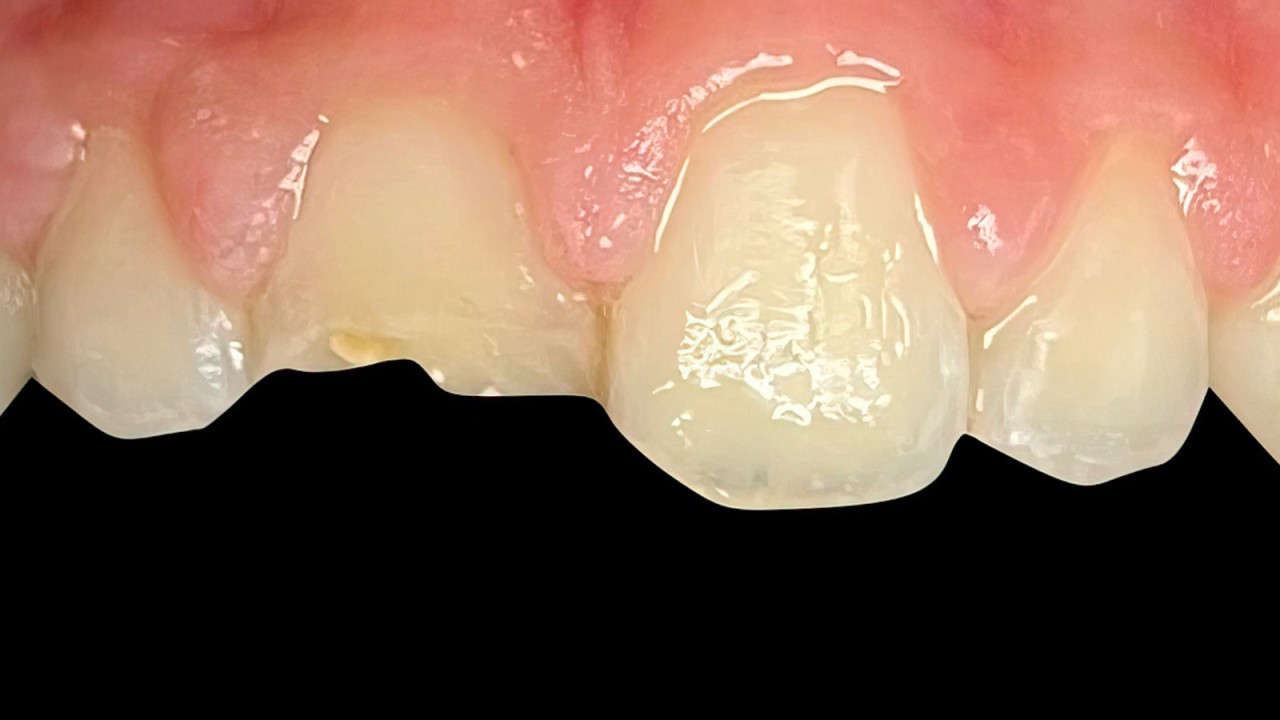 Venus® Pure Art and Pearl Shades