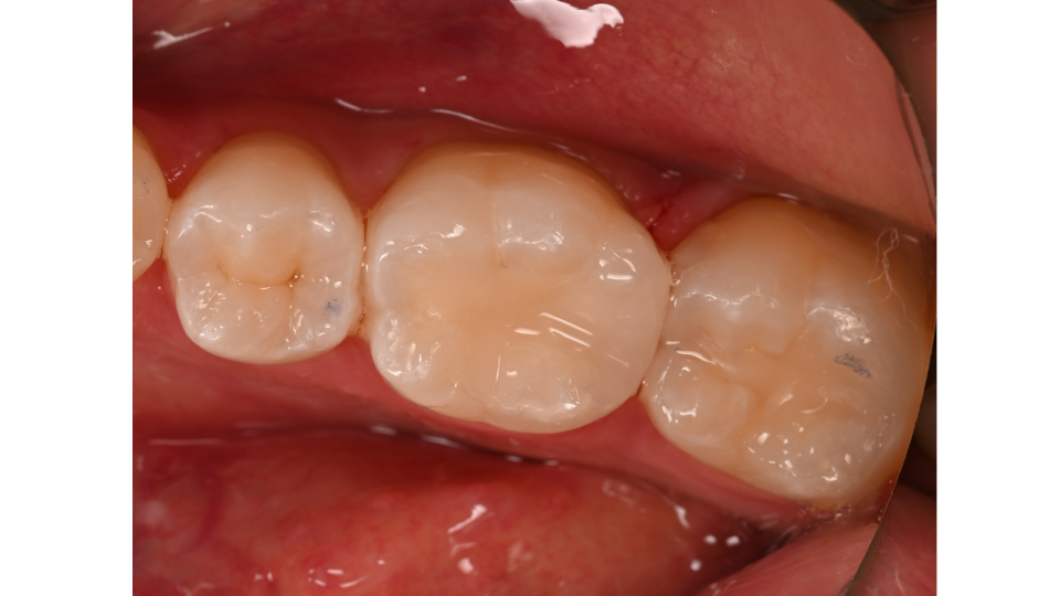 Be part of the Venus community