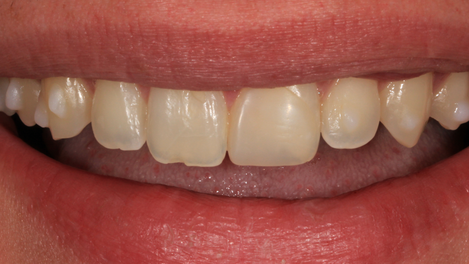 Be part of the Venus community