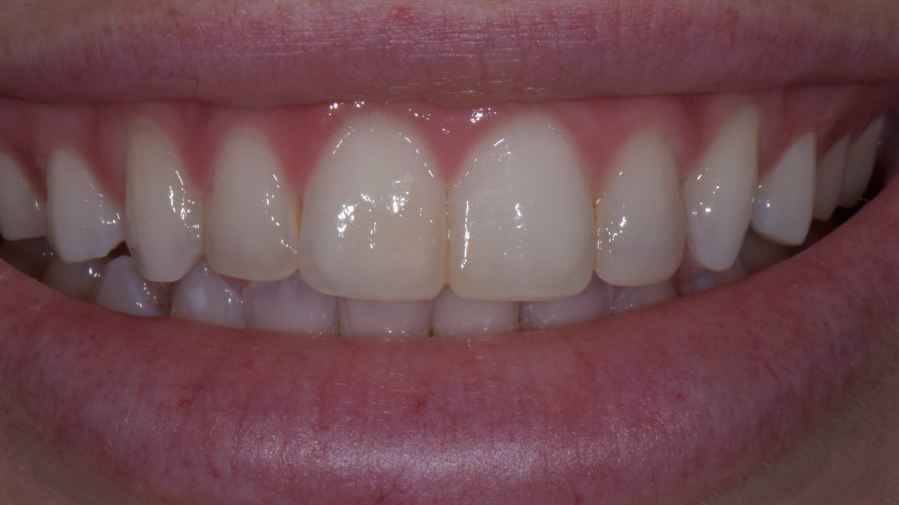 Be part of the Venus community