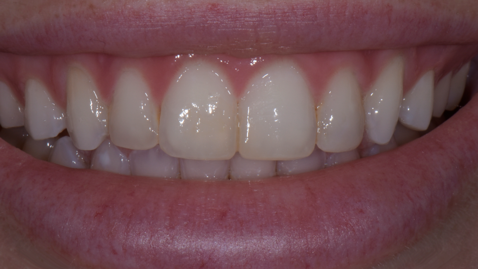 Be part of the Venus community