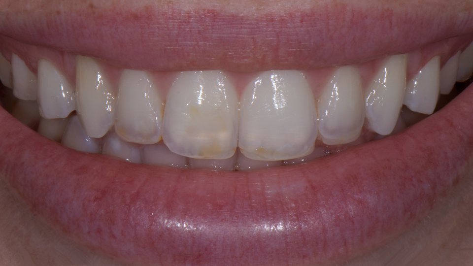 Be part of the Venus community