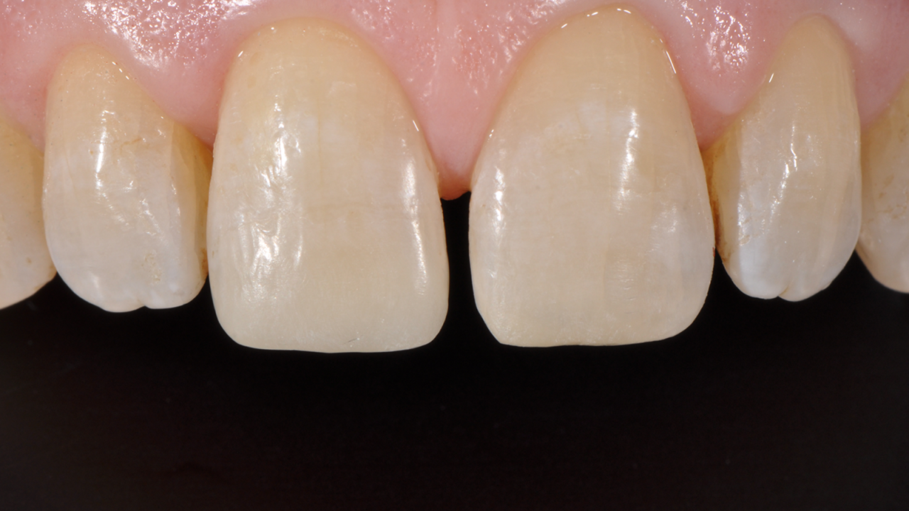 Be part of the Venus community