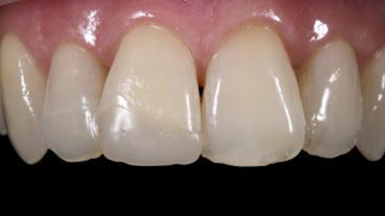 Venus® Pearl Art Shades