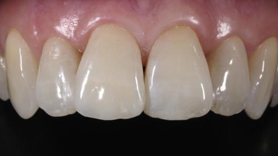 Venus® Pearl Art Shades