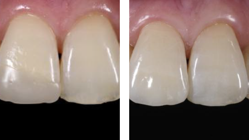 Venus® Pearl Art Shades